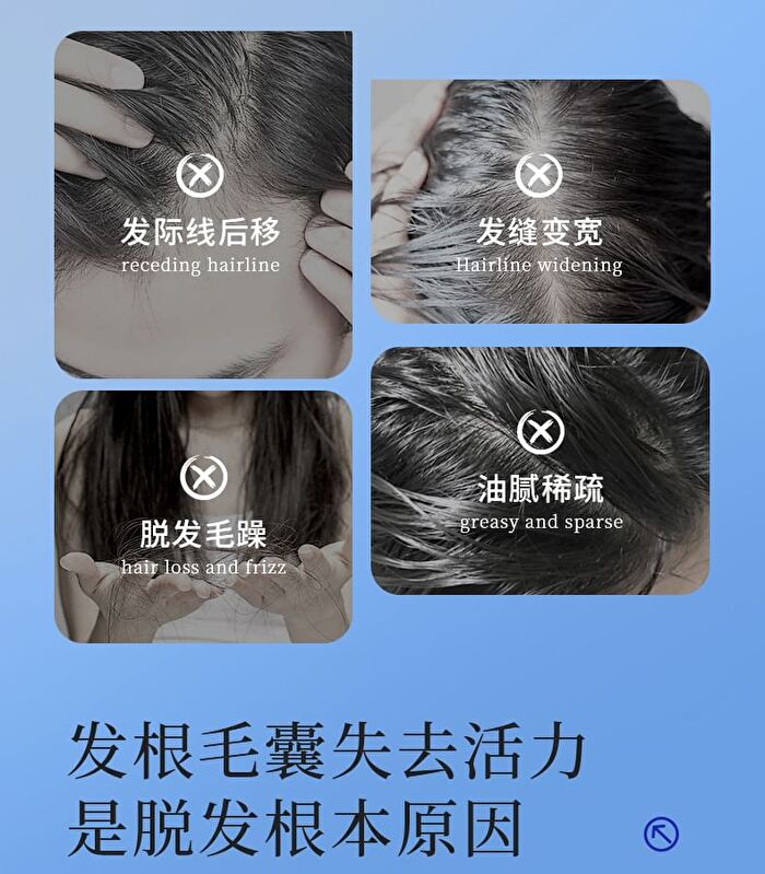 Anti Hair Loss and Breakage Strengthening Shampoo - 500ml | Cosmetics ...